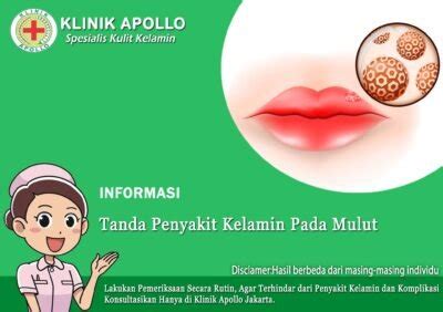 Penyakit Kelamin Pada Mulut Mengintai Kenali Tanda Itu Di Sini Klinik Apollo Jakarta
