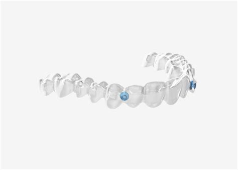 Invisible Orthodontics With Dental Aligner Angel Aligner