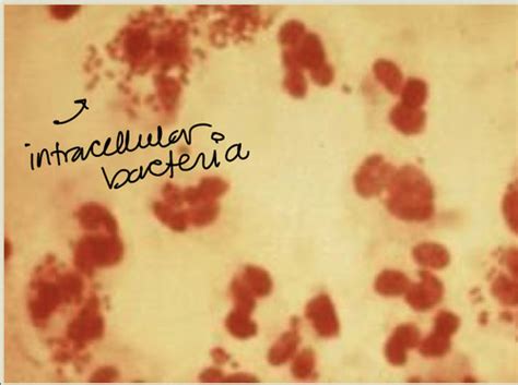 Clin Lab B3 Lecture 2 Flashcards Quizlet