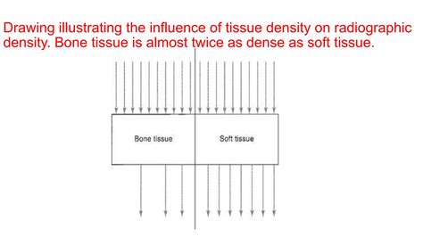 Radiographic Quality Density Contrast Detail Radiographic
