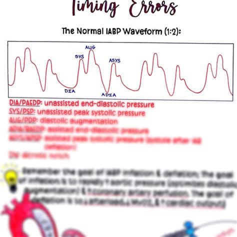 Iabp Timing Errors Etsy