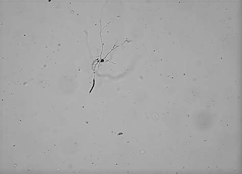 Single Spore Procedure Fusahelp