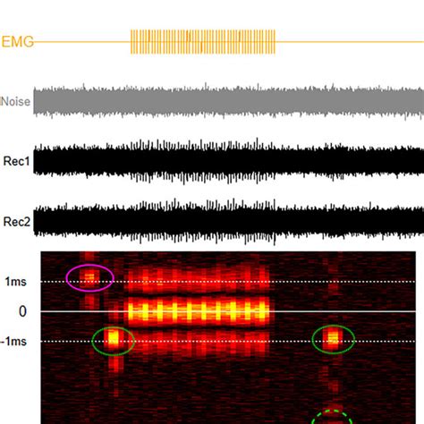 A Synthetic Model Of Our Cross Correlation Signal Processing Method Download Scientific A Synthetic Model Of Our Cross Correlation Signal Processing Method Download Scientific