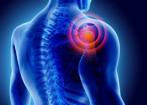 Physical Solutions Signs You May Have A Labrum Tear In Your Shoulder Physical Solutions