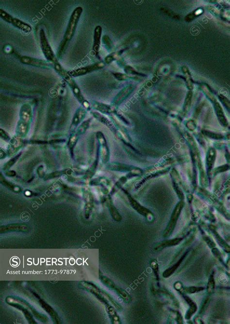 Photomicrograph Of Bacillus Anthracis Spores Superstock