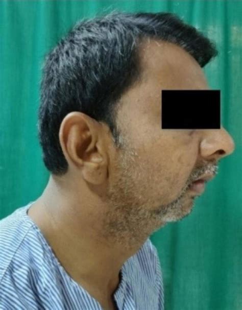 Postoperative Picture Of Patient Download Scientific Diagram