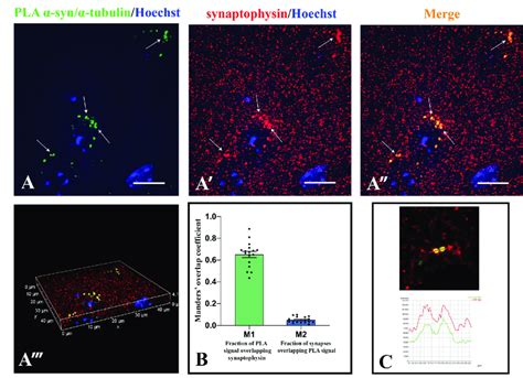Spinning Disk Analysis Of α Synucleinα Tubulin Interaction In The Download Scientific Diagram