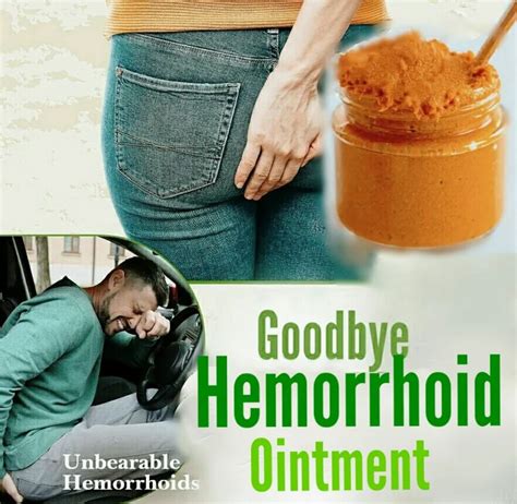 Thrombosed Hemorrhoid Burst Healing At Nicholas Packard Blog