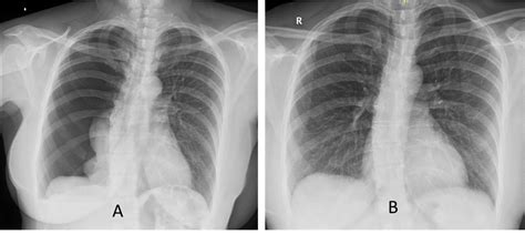 Bmh Medical Journal Ravindran
