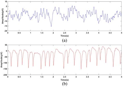 Target Eeg Waveform A Normal Eeg Waveform B Target Seizure Eeg