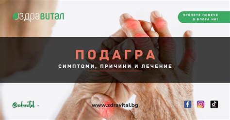 Подагра - Симптоми, Причини и Лечение - Здравитал