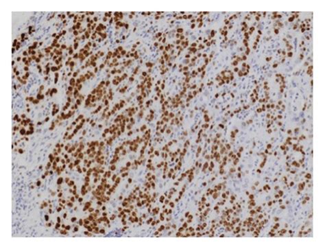 Pdgf B And Pdgf D Immunostaining A Pdgf B Negative Staining