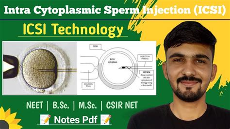 Icsi Technology Intra Cytoplasmic Sperm Injection By Dadhich Sir