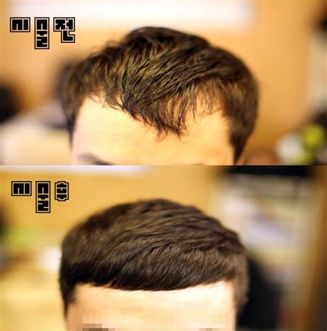남자 붙임머리 증모술 전문미용실 살롱드수이비 시티점 입니다 네이버 블로그