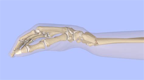 Closed Reduction Of A Distal Radius Fracture Orthopedic Surgery