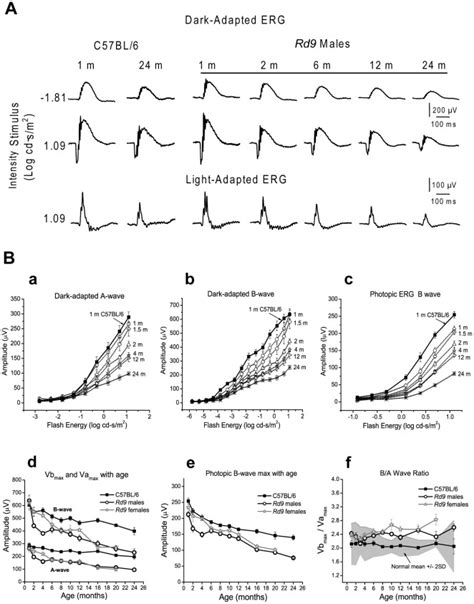 A Representative Dark Adapted And Light Adapted Ergs Waveforms For Download Scientific