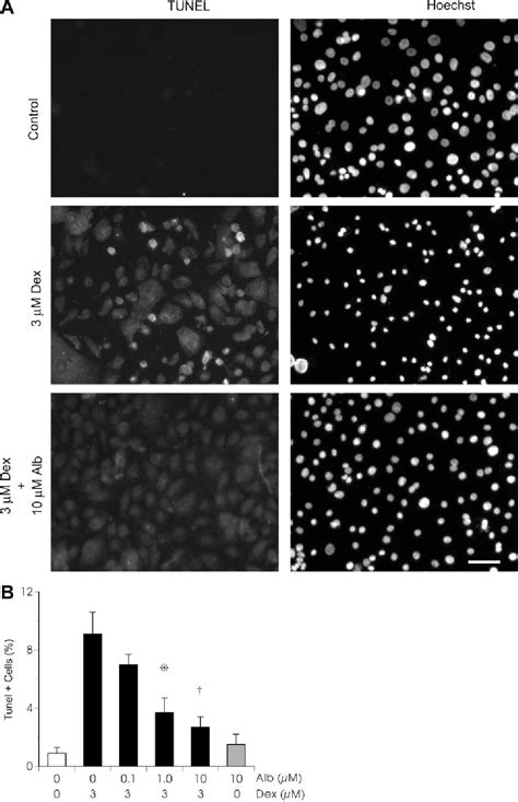 Figure 3 From β Adrenergic Agonists Inhibit Corticosteroid Induced Apoptosis Of Airway