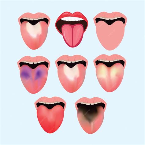 Premium Vector Tongue Diseases