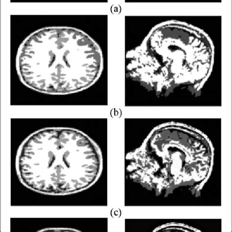 Comparison Of The Mdacm With The Multiphase Lbf And The Lic Models For Download Scientific