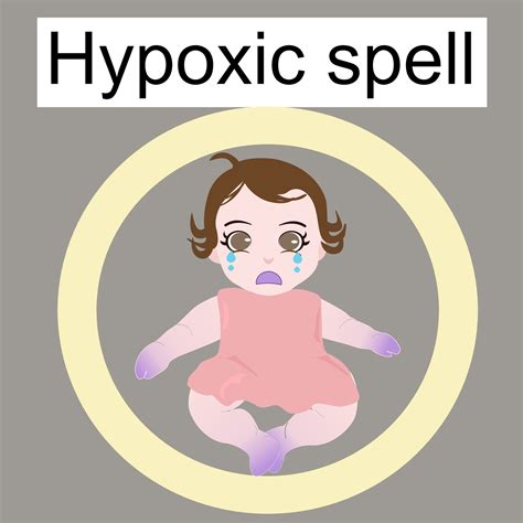 The Sign Of Hypoxia Spell Or Tof Spell There Are The Sign Of Central