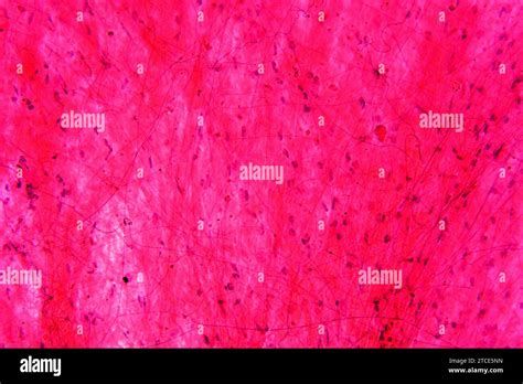 Reticular Fibers Lymph Node