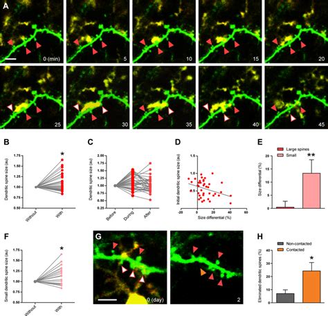 Structuraldynamic Interactions Between Microglia And Dendritic Spines Download Scientific