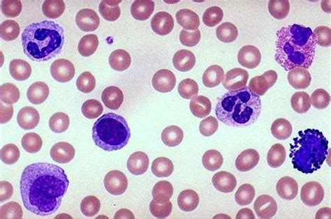 How To Identify Normal Leukocytes In A Blood Smear Pathology Babe