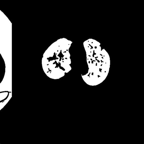 The Procedures Of Lung Parenchyma Segmentation A A Raw Thoracic Ct Download Scientific