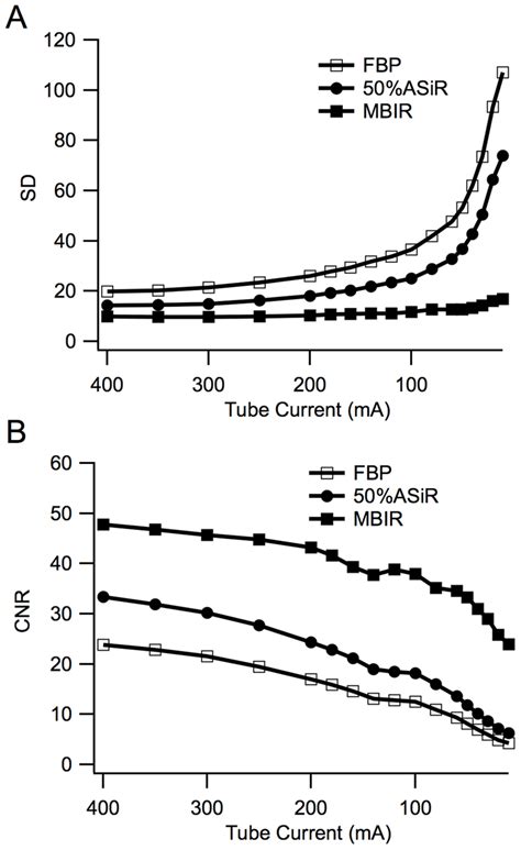 Image Noise Analysis Based On The Different Reconstruction Models The