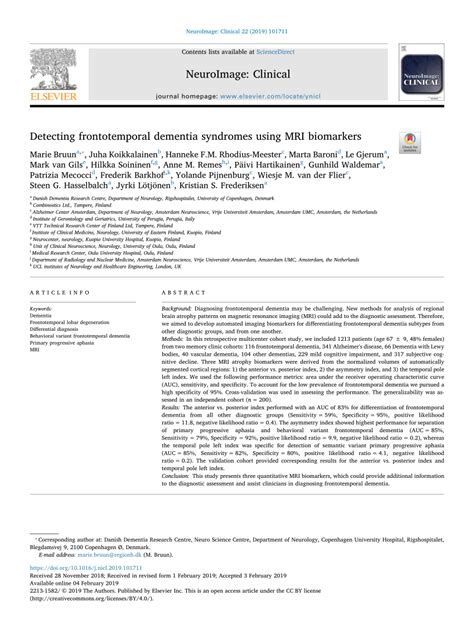 Pdf Detecting Frontotemporal Dementia Syndromes Using Mri Biomarkers
