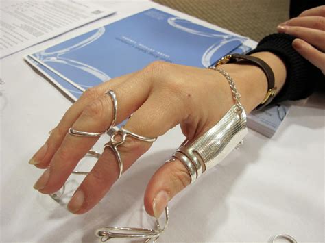 Ring Splints For Ehlers Danlos Syndrome Hypermobility 46 OFF