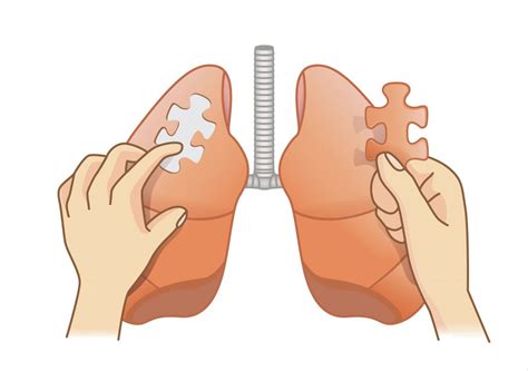 Open Thoracic Surgery Cardiothoracic Surgeons Cardiovascular