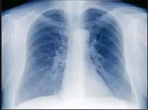 Quality Assurance Testing Of X Ray Services At In Noida ID