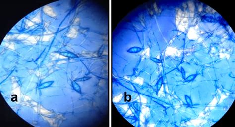 Microsporum Canis Culture