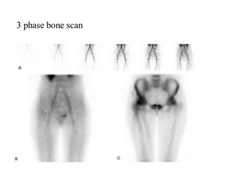 Nuclear Medicine And Radioactivity Flashcards Quizlet