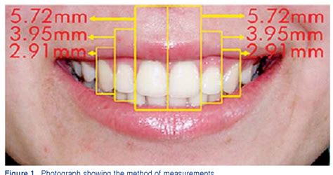 Figure 1 From Geometric And Mathematical Proportions And Their
