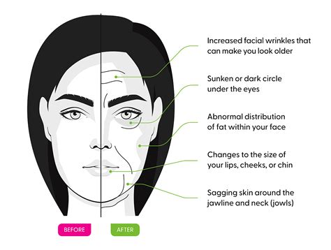 What Is Ozempic Face Can You Avoid It Superdrug Online Doctor