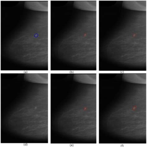 Full Article Awds Net Automatic Whole Field Segmentation Network For