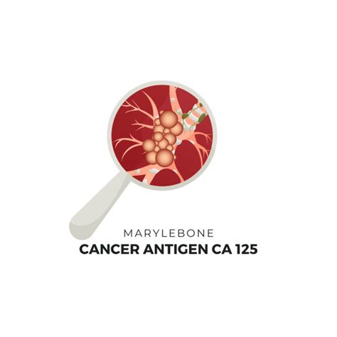 Cancer Antigen Ca 125 Marylebone Diagnostic Centre