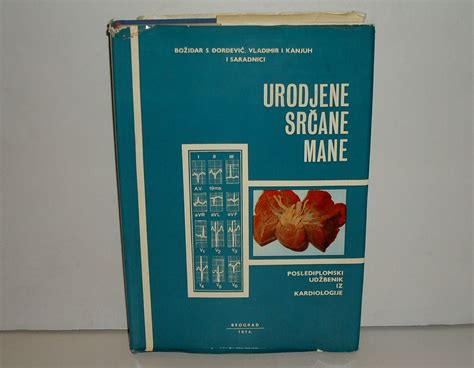 Urodjene Srcane Mane 13913069