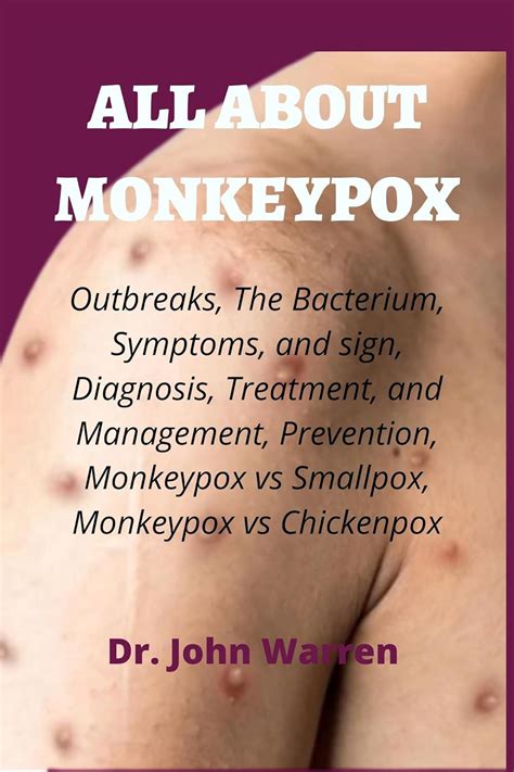 Amazon.com: ALL ABOUT MONKEYPOX: Outbreaks, The Bacterium, Symptoms ...