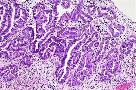 30 Facts About Hem Dysplasia