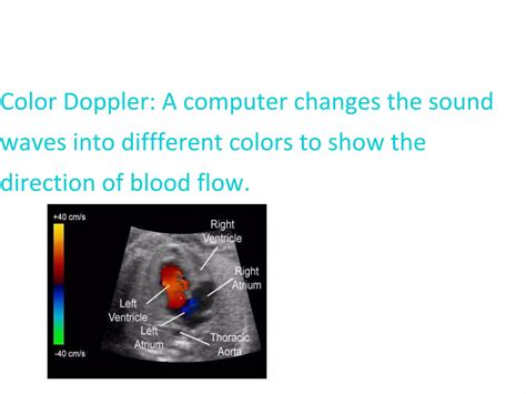 Color Doppler Ultrasound Docx