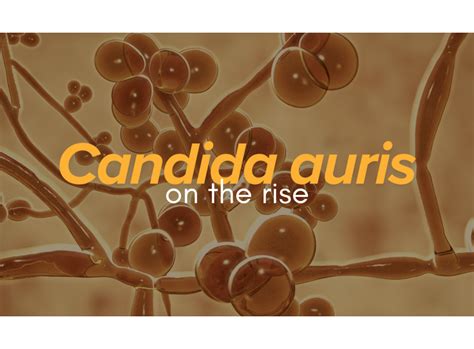 Pan Resistant Candida Auris On The Rise
