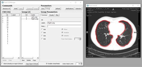 Contour Example 2 Contour Interpolation