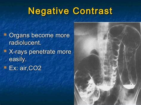 Contrast Media