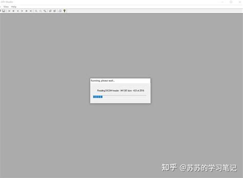 diffusion spectrum imaging dsi 扩散光谱成像 与 diffision tensor imaging （dti