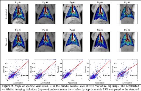 Figure 2 From Accelerated Whole Lung Specific Ventilation Imaging In Large Species With