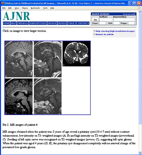 The User Has Clicked On One Of The Thumbnail Images In The Image