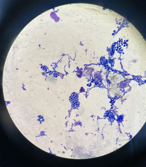 Abdominal Fluid Sample R Microbiology